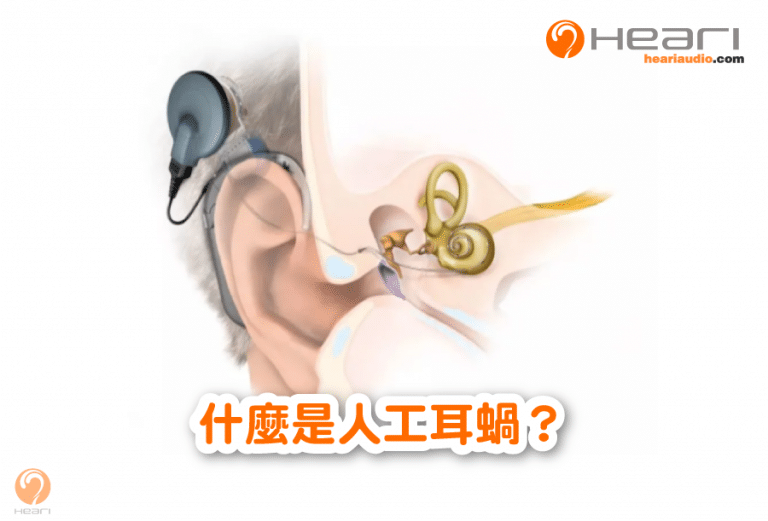 什麼是人工耳蝸？ 香港助聽器中心 捷成集團旗下本地研發 Heari 傾耳聽助聽器